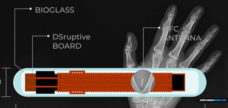 The Developer Of Human Implantable COVID Microchip Dsruptive Subdermals ...